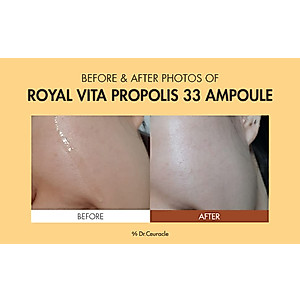 Dr.Ceuracle Royal Vita Propolis 33 Ampoule (15ml / 0.50 fl. oz.) - Ultimate Glow and Nourish Vitamin Serum for Radiant Skin, Formulated with Propolis and Royal Jelly Extract