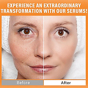 Vitamin C Serum for Face, Gentle Anti-Aging Facial Treatment with Hyaluronic Acid -Arouse Skin Energy, Firming & Hydrating, Improve Skin Luster