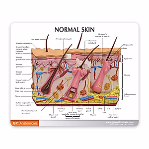 Skin Burn Model | Human Body Anatomy Replica of Varying Degrees of Skin Burn for Dermatology Educational Tool | GPI Anatomicals