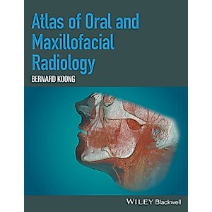 Atlas of Oral and Maxillofacial Radiology