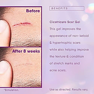 Cicatricure Face & Body Scar Gel, Scar Treatment for Old & New Scars, Stretch Marks, Surgery, Injuries, Burns and Acne Scar Treatment, 1 Ounce