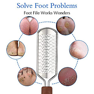 Professional Pedicure Foot File, Colossal Stainless Steel Detachable Foot Scrubber, Hard Skin Removers Pedicure Rasp for Wet and Dry Feet