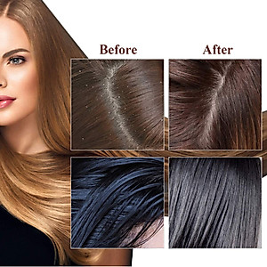 ARGANMIDAS Anti-Dandruff Moisturizing Shampoo for Dry, Flaky and Itchy Scalp - Treats and Prevents Dandruff for Women and Men, 15.3 Fl Oz