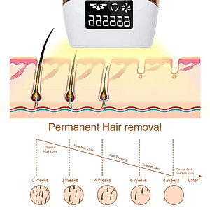 Huieter IPL Hair Removal Permanent Painless Laser Hair Remover Device for Women and Man Upgrade to 999,999 Flashes for Facial Legs, Arms, Armpits, Body, at-Home Use (White)