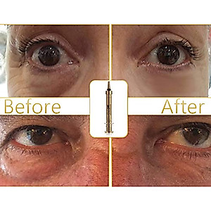 GLO24K Instant Facelift Cream with 24k Gold, Hyaluronic Acid, Peptides, and Vitamins, A,C,E. A powerful non-invasive alternative to injections.