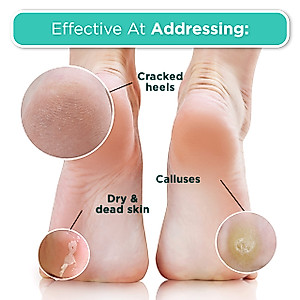 DERMORA Foot Peel Mask - 2 Pack of Regular Size Skin Exfoliating Foot Masks for Dry, Cracked Feet, Callus, Dead Skin Remover - Feet Peeling Mask for baby soft feet, Tea Tree Scent