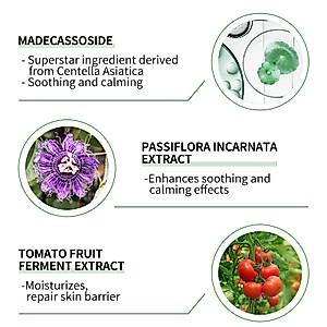 Acne Treatment Face Serum, 10% Salicylic Acid, Pimples Remover & Dead Skin Peels, Relieve Redness Rosacea Blemish, Centella Asiatica Soothing Calming, Acne Prone Sensitive Facial Skin Care, 30ml