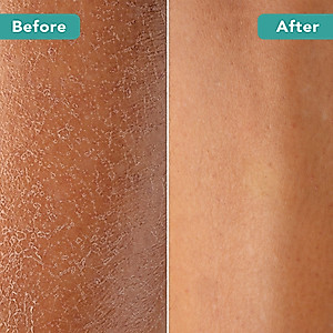 Dry Brushing Body Brush for Lymphatic Drainage & Cellulite - Round Dry Brush for Body Natural Bristle Body Brush for Showering - Skin Brush for Dry Brushing Bath and Exfoliating