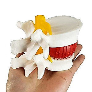 2023 New Human Anatomical Lumbar Herniation Model, Vertebrae Degenerative Lumbar Human Spine Model 1PCS,Lumbar Spine Model for Teaching & Learning - Excellent Way for Demonstrating Disc