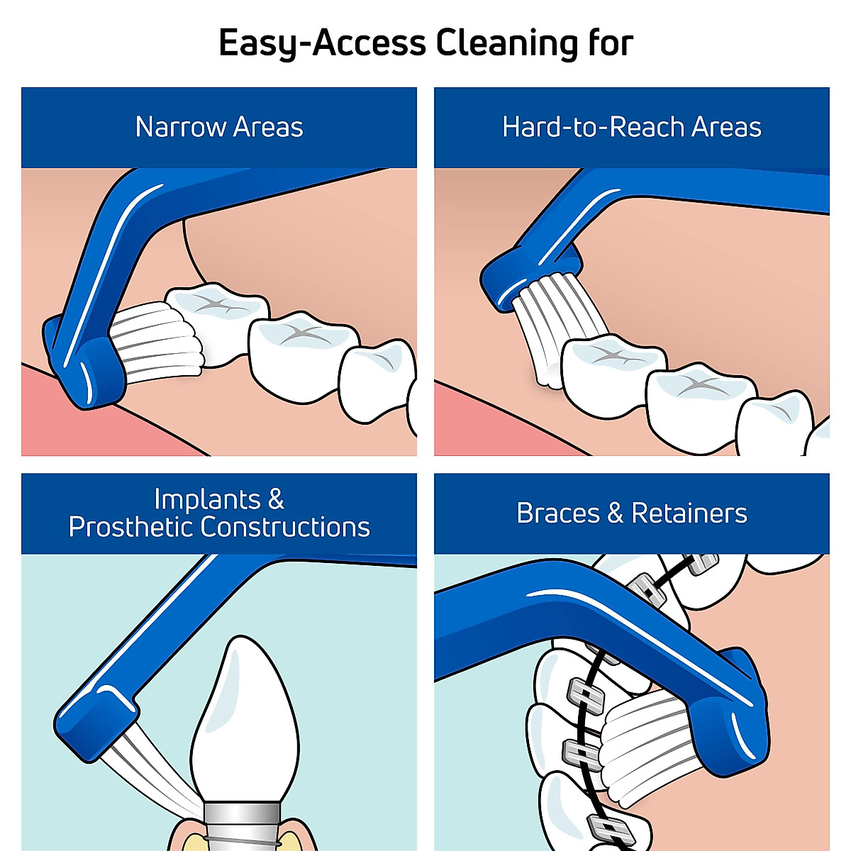 TEPE Angled Soft Bristle Toothbrush, Orthodontic Toothbrush for Braces, Small Head Toothbrush for Retainers, Implants, Universal Care, 1 Pk