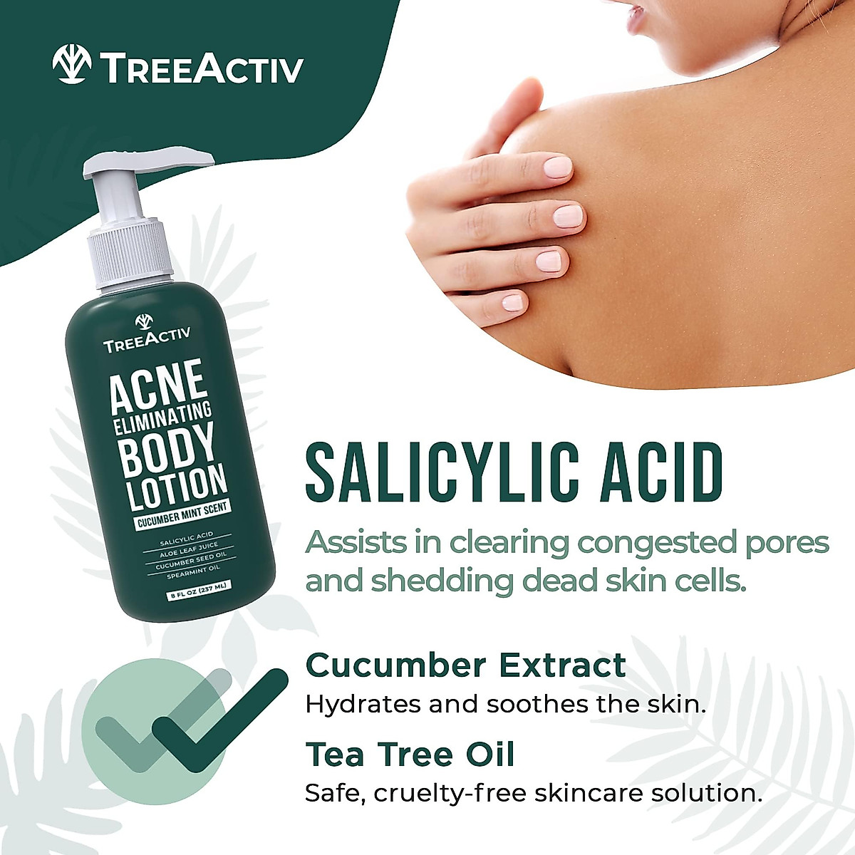 TreeActiv Acne Eliminating Body Lotion, 8 fl oz, Salicylic Acid Lotion, Salicylic Acid Body Acne Treatment, Back Acne Treatment Cream for Women and Men, Acne Lotion for Body, Zit Cream with 2000+ Uses