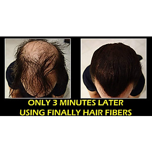 Finally Hair Fiber Lock Strong Holding Spray. Compatible/Replacement For Toppik, Xfusion, Febron, Bosley, Nanogen