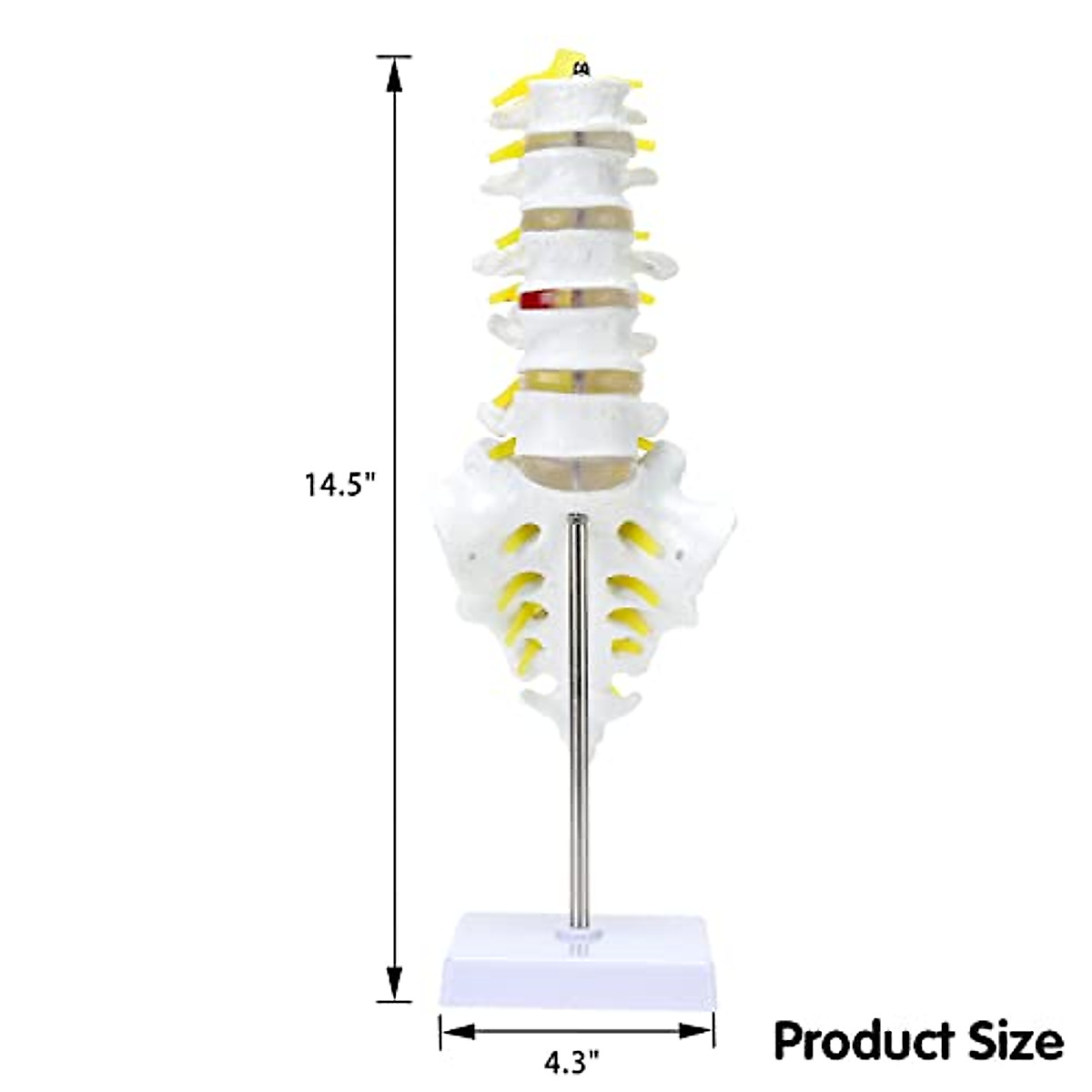 MIIRR Life Size Lumbar Spine Anatomical Model with A Herniated Disc at L4, Lumbar Spine Model with Sacrum and Spinal Nerves
