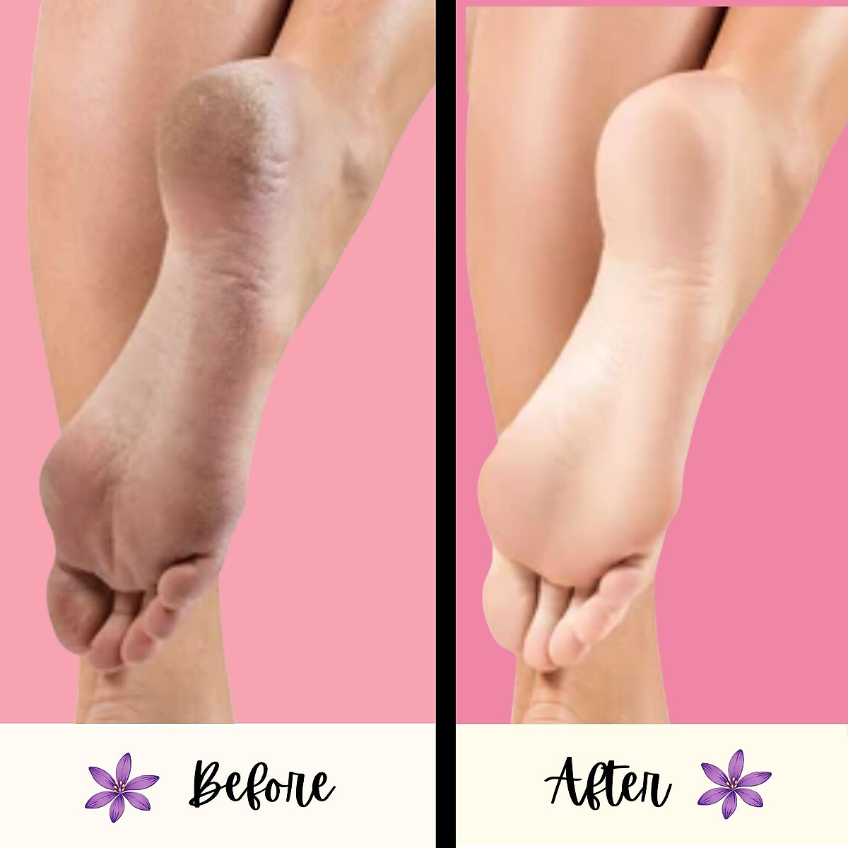 Mr. Pumice Purple PUMI Bar, Extra-Coarse Callus Remover, Pedicure Stone & Ped File Scrubber for Smooth Feet and Heels, 6 Pack