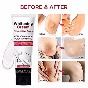 Crema Aclaradora Para Piel Manchas En Cara Axilas Cuello Entrepierna-n3