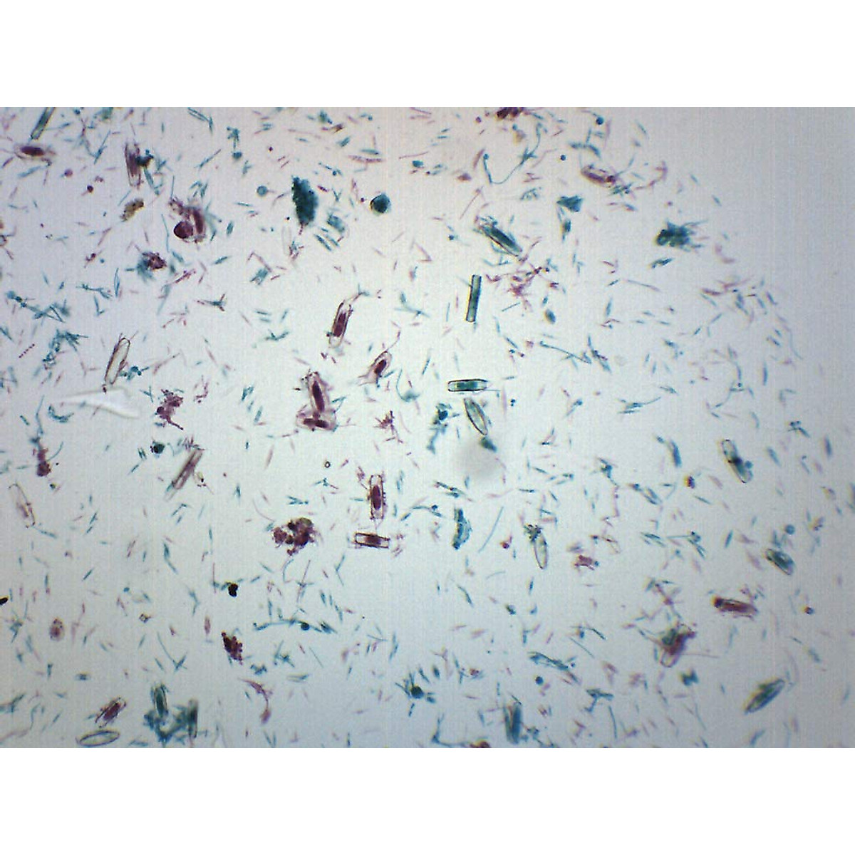 EISCO 10PK Mixed Diatoms, Wholemount - Prepared Microscope Slides - Classroom Pack, 10 Slides in Storage Case - Biology & Microscopy