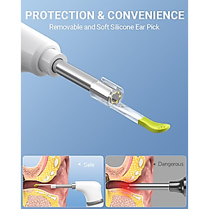 ScopeAround Wireless Otoscope with Light Ear Camera, 3.9mm Ear Wax Removal Tool Camera, 720P HD with 6 LED Lights, WiFi Wireless Otoscope Camera, Ear Scope Compatible with Android and iPhone