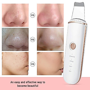 Skin Scrubber, Skin Spatula, Pores Cleanser Exfoliator Blackhead Remover Comedones Extractor for Facial Deep Cleansing with 4 Modes Include 4 Pcs Acne Reml Tool