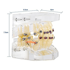 Teeth Educational Model Dental Treatment Malocclusion Study Demonstration Teeth Model with Wire Chain Orange