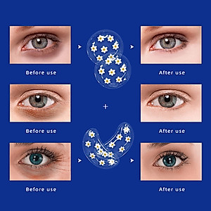 Gel Ice Pack Reusable Cooling Under Eye Pads and Patches, Hot Cold Treatment Pack for Redness,Pain Relief and Eye Relax