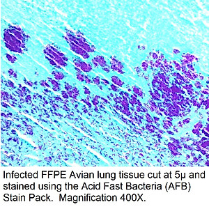 Acid Fast Bacteria (AFB) Stain Pack, 125ml