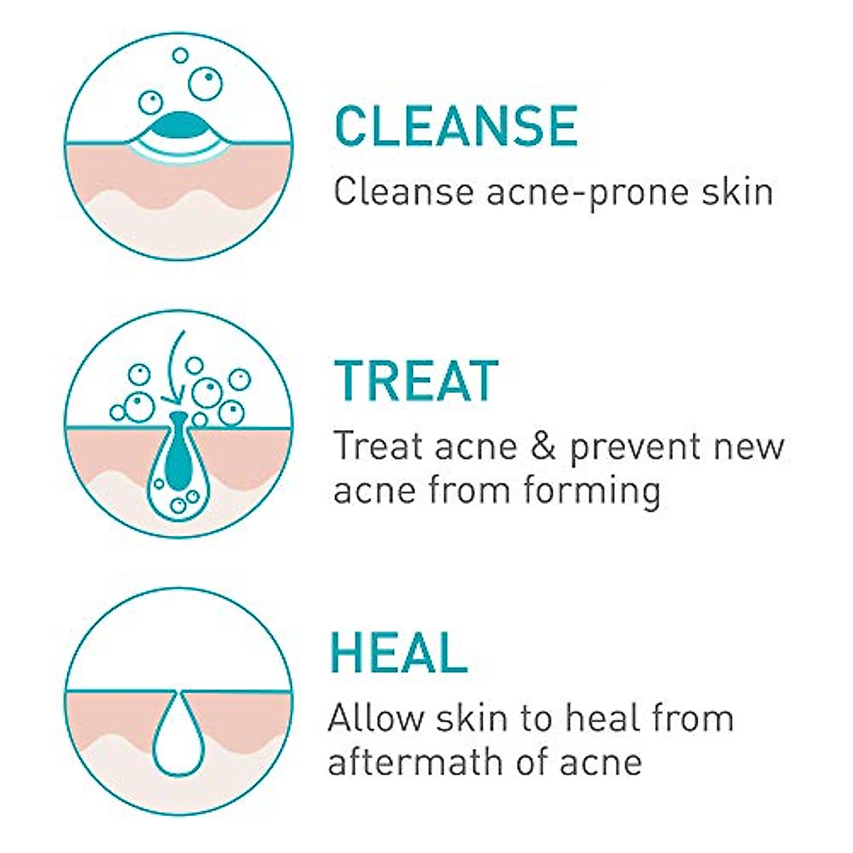CeraVe Acne Treatment Face Wash and Retinol Serum Bundle | Contains One Acne Foaming Cream Cleanser (5 Ounce) and One Brightening Facial Serum for Post-Acne Marks and Pores (1 Ounce)