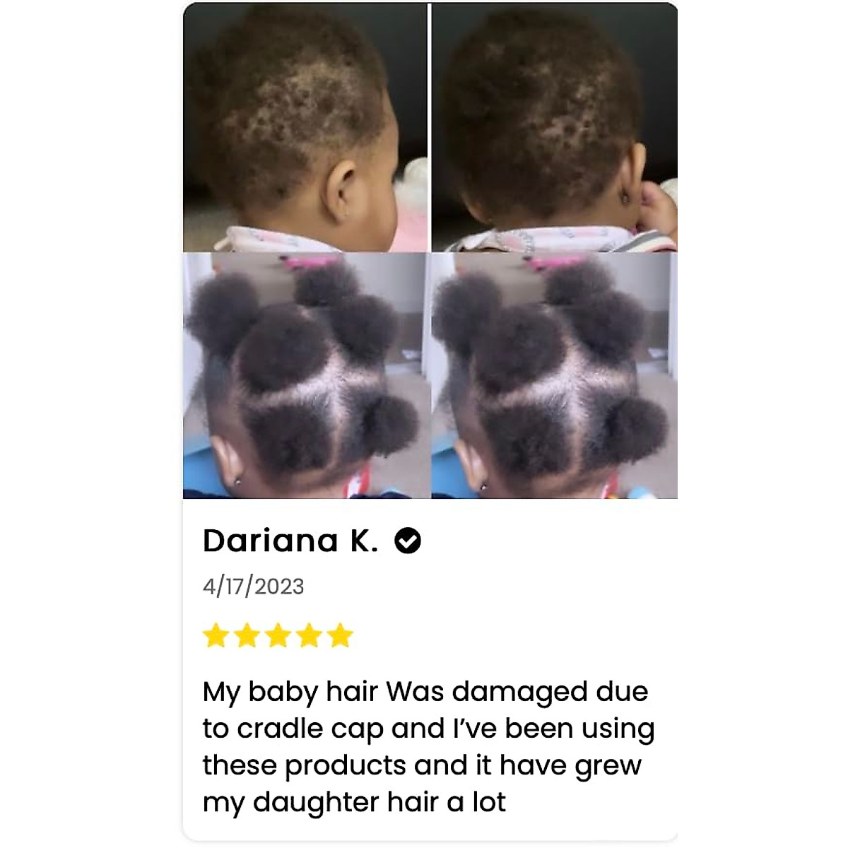 J'Organic Solutions Kid's Biotin Growth Stimulating Conditioner (8oz with Argan Oil, Aloa Vera & more)