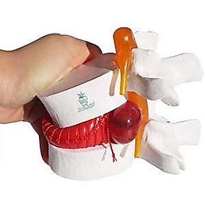 Doc.Royal Anatomical Human Lumbar Vertebrae Degenerative Lumbar Human Spine Model 1PCS