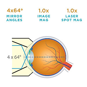 VG4 Volk Gonio G4 Lens with Flange, Large Ring, Protective Case