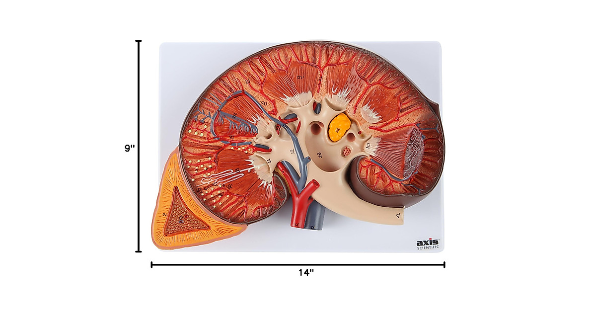 3x Life-Size Human Kidney Model with Anatomy & Manual | Axis Scientific
