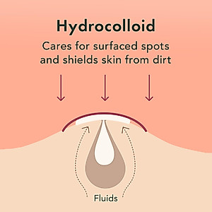 Rael Pimple Patches, Miracle Invisible Spot Cover - Hydrocolloid Acne Pimple Patches for Face, Blemishes and Zits Absorbing Patch, Breakouts Treatment Skin Care, Facial Stickers, 2 Sizes (24 Count)