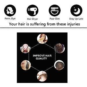 Ginger Hair Growth Germinal Oil, Regrow 7 Days Ginger Germinal Serum for Nourishing Hair Roots, 30ML (3pcs)