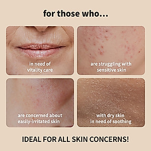 BENTON Snail Bee High Content Skin (Toner) - Snail Secretion Filtrate & Bee Venom - Moisturizing & Soothing Toner for Oily, Acne-Prone Skin - Dermatologically Tested, 5.07 fl. oz.