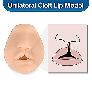 Ultrassist Unilateral Cleft Lip Model, Cleft Lip Suture Training Simulator for Medical Students, Education, Display