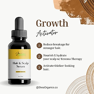 Shea Organics Soothing Scalp Oil | Scalp Care| Dandruff & Itchy Scalp Serum | Helps with Dry Scalp & Baby Scalp Eczema | 1oz | With Oat Oil, Vitamin E, Honey, Tea Tree, and Colloidal Oatmeal