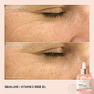 BIOSSANCE Squalane + Vitamin C Rose Oil, 30ml