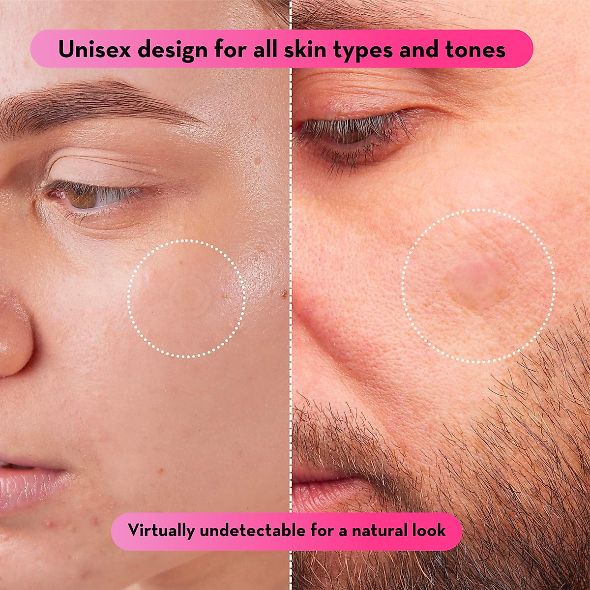 LE GUSHE Pimple Patches for Face (132 dots) - Hydrocolloid Acne Patch for Zits and Blemishes - Invisible Blemish Patches for Face - Spot Cover Stickers