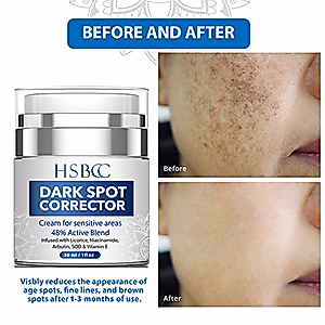 Dark Spot Remover for Face and Body, Dark Spot Corrector for Face, Sun Spots Melasma Cream and Freckle Remover- Formulated with Arbutin, Niacinamide & Vitamin E