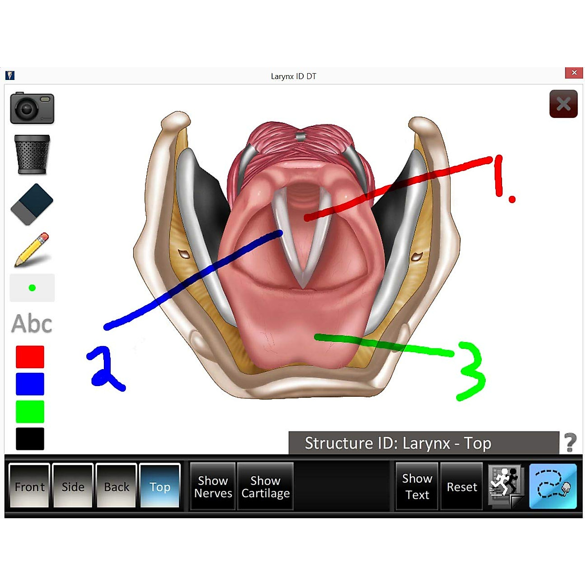Vocal Parts, Pharynx & Larynx Anatomical Chart with Software Larynx and Vocal Fold ID Speech Language Pathology, SLP, Singing