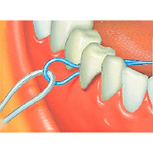 FLOSSAID BridgeAid Threaders 10 Packs of 10 (100 Threaders)