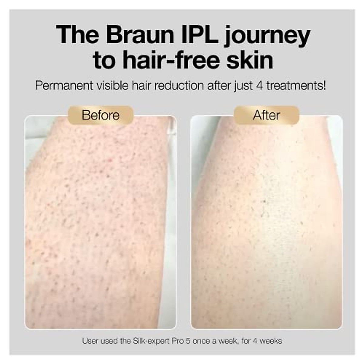 Braun IPL Hair Removal for Women and Men, New Silk Expert Pro 5 PL5157, for Body & Face, Long-lasting Hair Removal System, Alternative to Salon Laser Hair Removal, with Venus Razor, Pouch