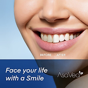 Teeth Whitening Kit - Pen with 32X Powerful Blue-Red Rechargeable LED Light, Effective for Sensitive Teeth, Comfortable and Accelerated Teeth Whitening by AsaVea Smile