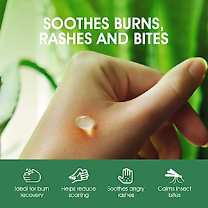 ORISO Aloe Vera Gel With Cold Pressed Aloe Vera - Pure Sunburn Relief, Bug Bites, Small Cuts - Soothing Moisturizer Lotion For Face, Hair and Body - 10 Fl Oz