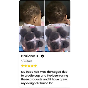 J'Organic Solutions Kid's Biotin Growth Stimulating Conditioner (8oz with Argan Oil, Aloa Vera & more)