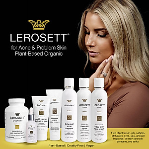 LEROSETT Facial Clay for Acne, Spot Treatment & Clay Mask, For Oily & Congested Skin, Reduces Blemishes, Blackheads & Pimples, Removes Ingrown Hairs, Tighten Pores, Vegan, 650+ Uses