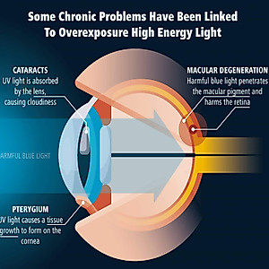 ZenHoo For Nintendo Switch (2017), Anti Blue Light [Eye Protection] Tempered Glass Screen Protector