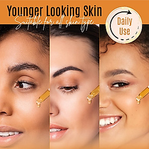 DERMAXGEN 30% Vitamin C Serum for Face, Hyaluronic Acid + Vitamin (B3 + E) + Jojoba + Aloe Vera- Natural & Organic Anti Wrinkle & Skin Rejuvenator Moisturizer Vitamin C for All Skin - Anti Aging Serum (1 FL OZ)