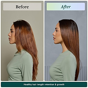 ALODIA Nourish & Grow Hair and Scalp Treatment - Avocado Oil & Rosemary Pre-Shampoo and Hot Oil for All Hair Types - 8 oz