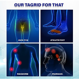 Top-Notch Jock Itch Cream, Jock Itch, Jock Itch Cream Extra Strength for Men & Women, Itchy Balls Cream, Yeast Infection Treatment for Men & Women, Itch Cream - Powerful and Fast - 60g