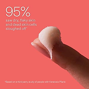 Peach & Lily KP Bump Boss Microderm Body Scrub | 10% AHA (7% Glycolic Acid + 3% Lactic Acid) | Smooth, Silky-Soft And Radiant Skin | Clean, Non-Toxic, Cruelty-Free | 8.11 Oz